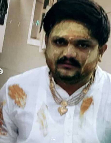 PHOTOS: Patidar leader Hardik Patel gets married to childhood friends ...