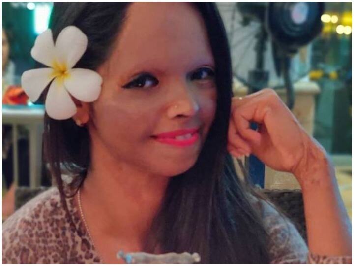Acid Attack Survivor Laxmi Aggarwal Says It Is Not Make Up Which Makes ...