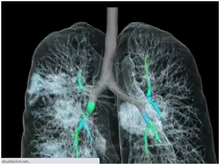 If you witnessing changes in your body, these could be warning signs ...