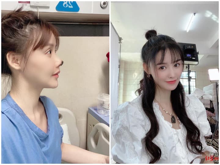 Chinese actress Gao Liu had to undergo cosmetic surgery heavily | चीन ...
