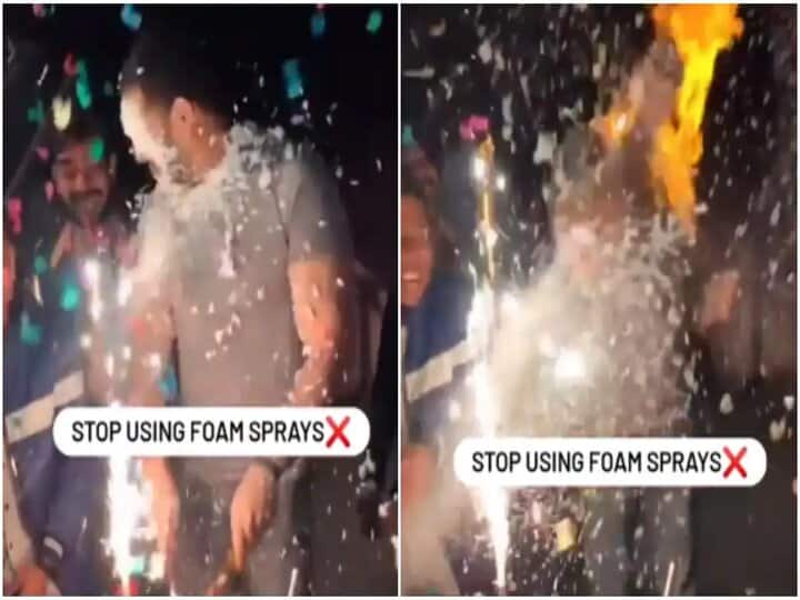 Viral: Birthday Boy\'s face burnt with snow foam spray, fire started as ...