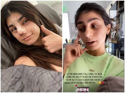 Mia Khalifa Undergoes Nose Surgery, Now Photos Going Viral | ਮੀਆ ਖਲੀਫਾ ...